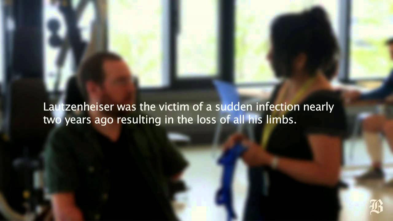 Moving forward with leg transplants - YouTube