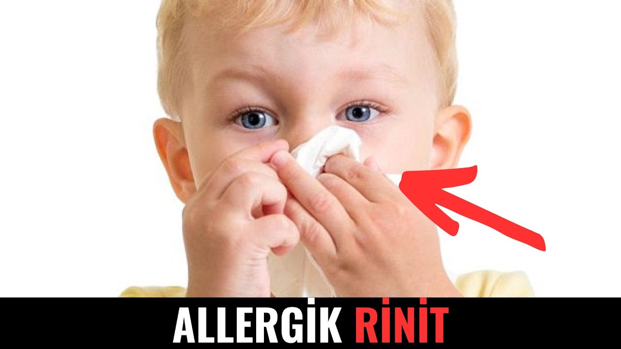Uşaqlarda Allergik Rinit Nələrə Səbəb Olur? MÜTLƏQ BAXIN! - YouTube