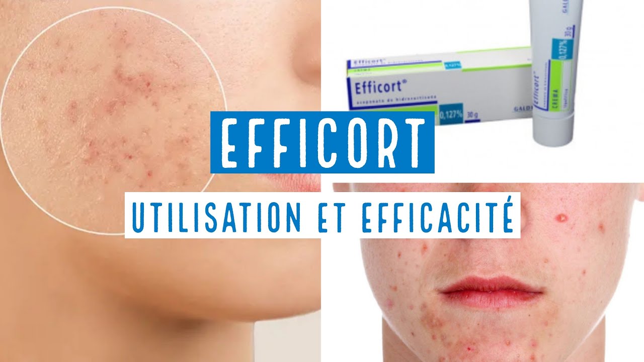 EFFICORT CRÈME 0.127% - YouTube