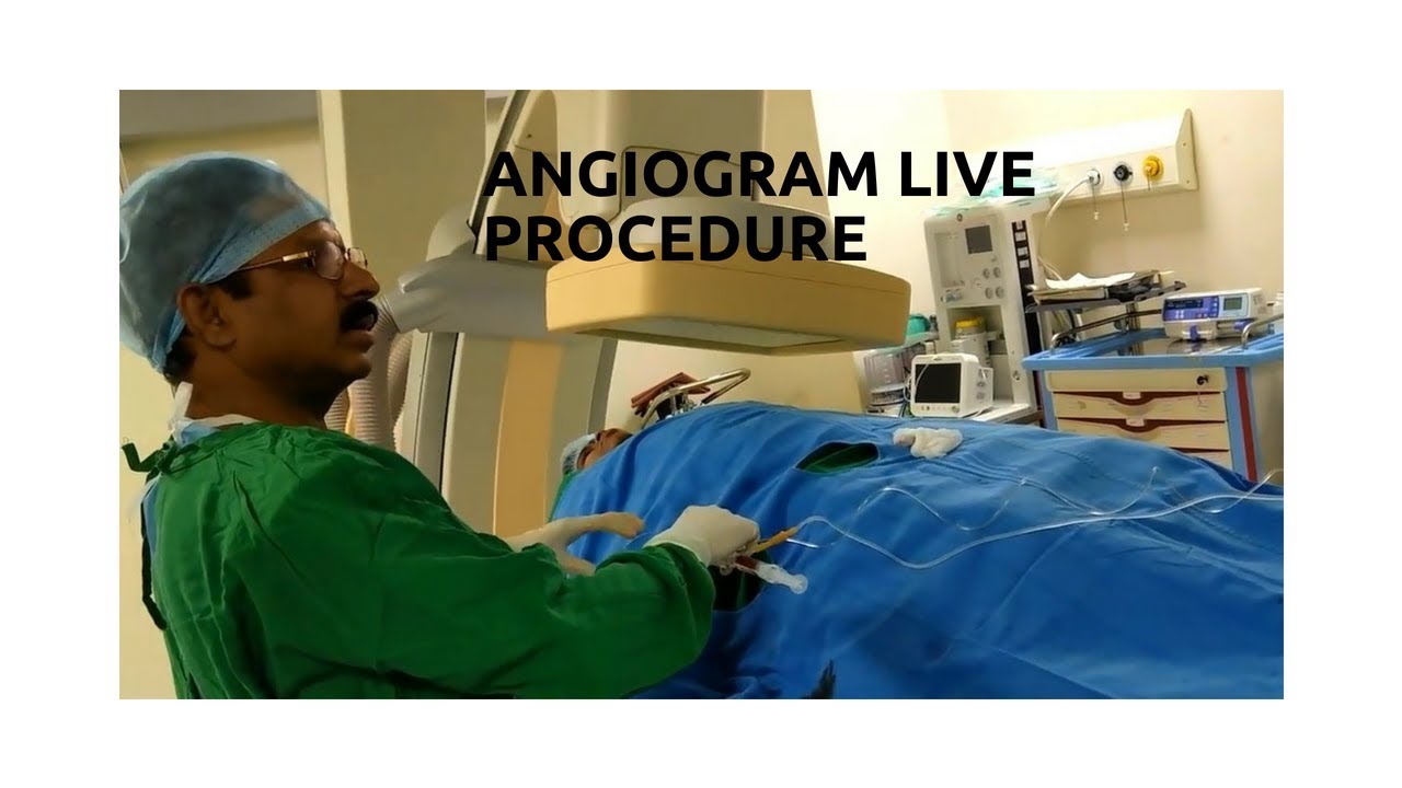 Angiogram Live Procedural Video - YouTube