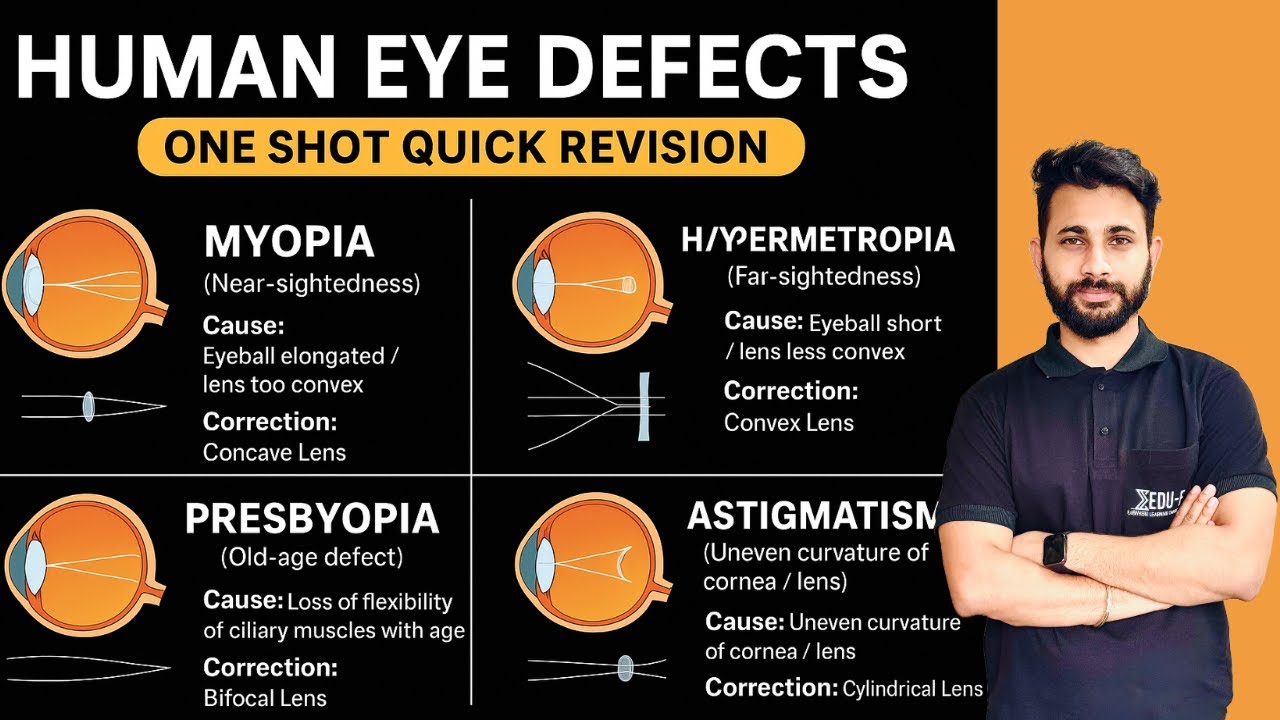 Human Eye Defects | Myopia, Hypermetropia, Presbyopia & Their ...