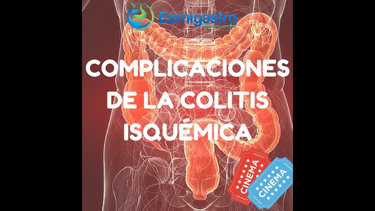 Complicaciones de la Colitis Isquémica - YouTube