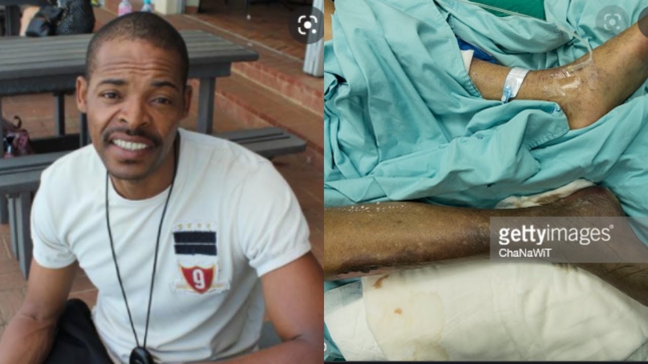 Actor Israel Matseke-Zulu Is Seriously Sick//He Suffers From A Rare ...