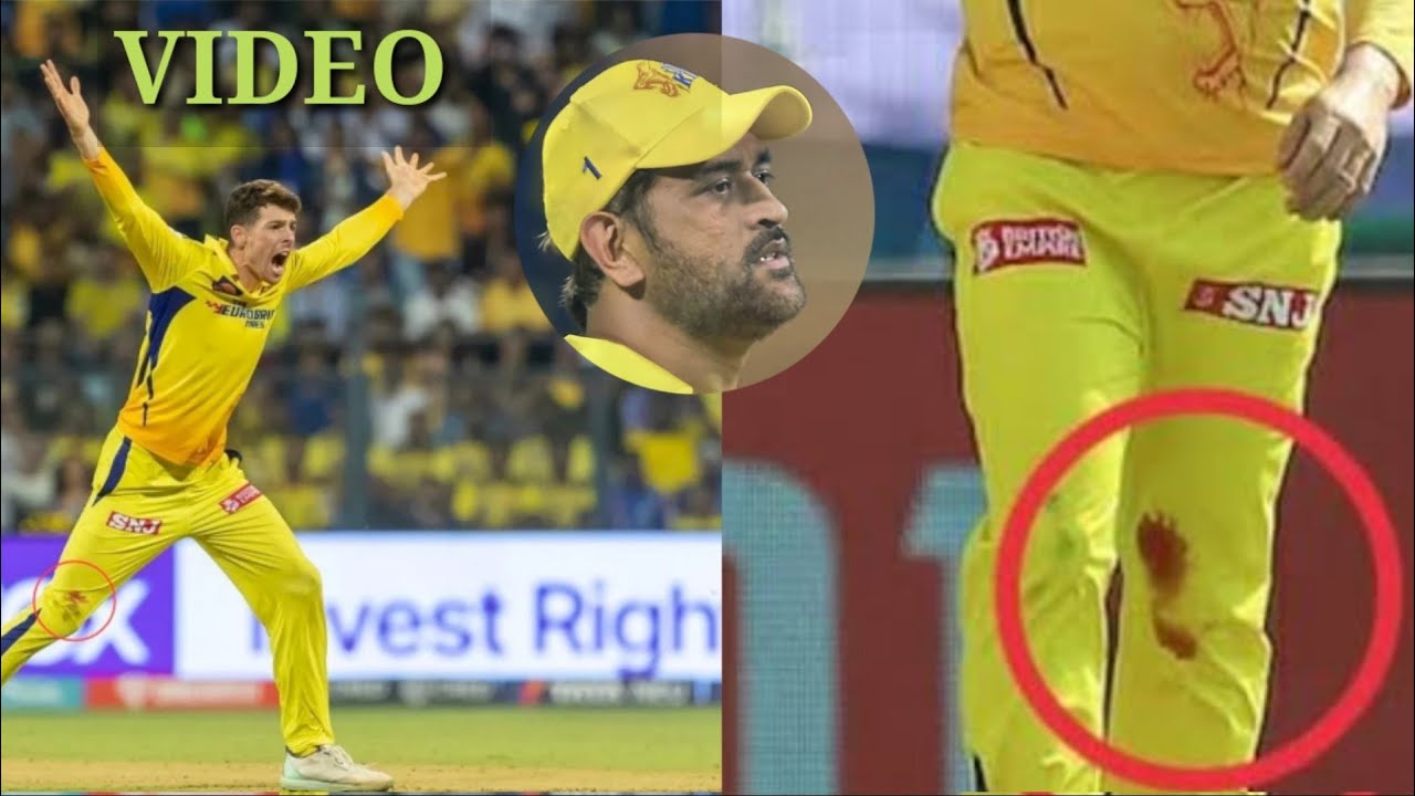 IPL 2023 : Mitchell santner Bleeding When bowling in CSK vs MI, Ms ...