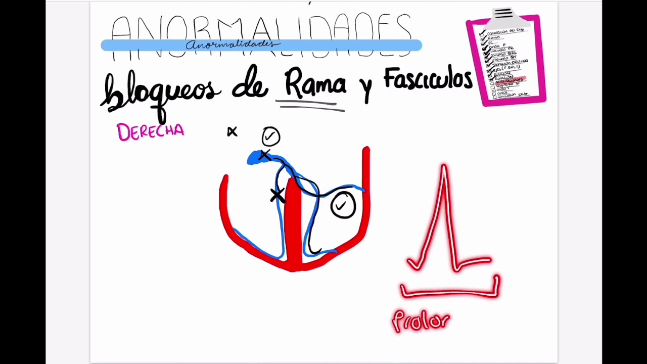 ELECTROCARDIOGRAMA (EKG) ANIMADO PARTE 4 FINAL - YouTube