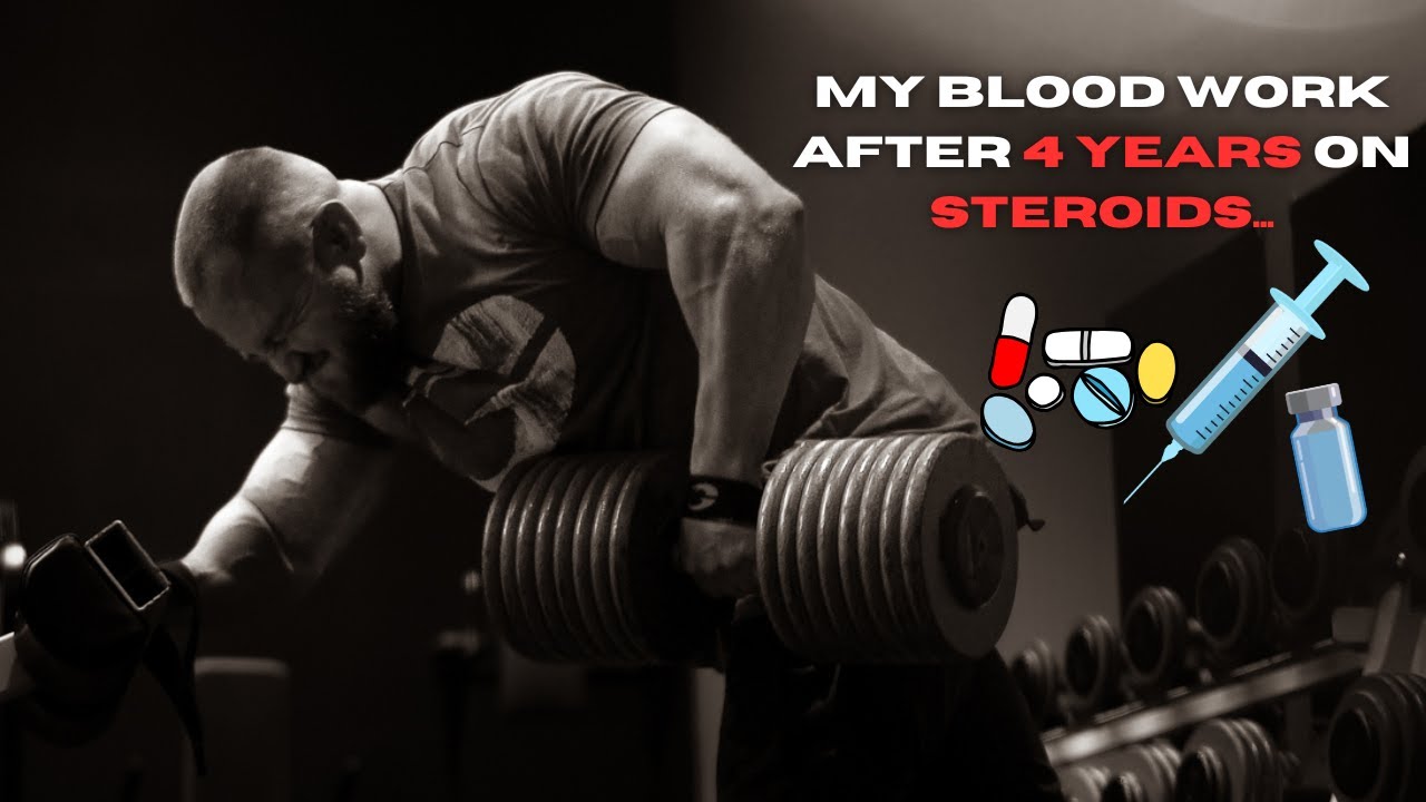 MY BLOOD WORK AFTER 4 YEARS ON STEROIDS | RAW BACK & BICEPS SESSION ...