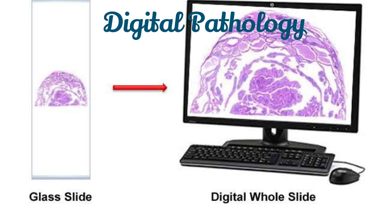 Digital slide scanners in Pathology - YouTube