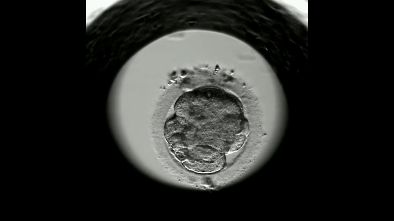 Blastocyst seen with Primo Vision - YouTube