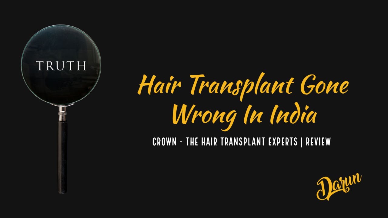 😔 Hair Transplant Gone Wrong In India | Can Hair Transplant Cause Death Informative Video ...
