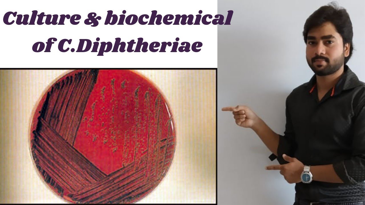 Corynebacterium | C.Diphtheriae | Lab Diagnosis | Culture ...