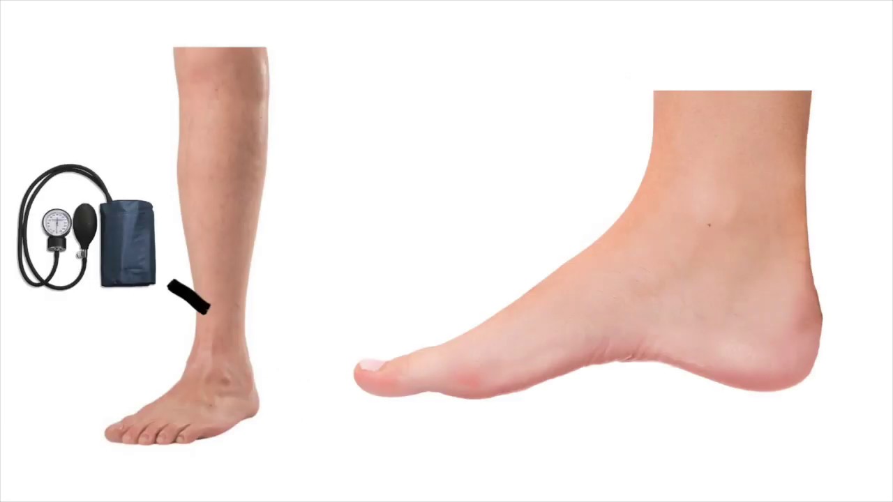 4.3: Peripheral Pulses & ABI - YouTube