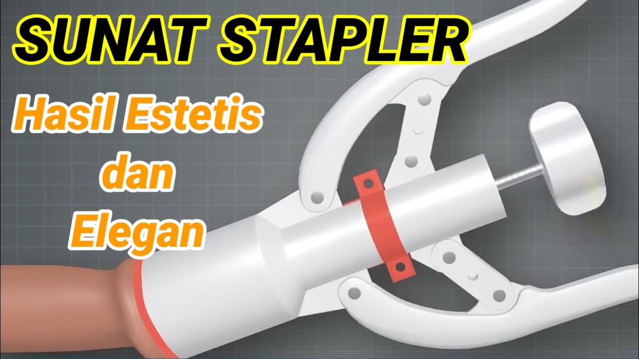 SUNAT STAPLER MODERN, COCOK BUAT DEWASA !! MUALAF & Anak2 || Mahal tapi ...