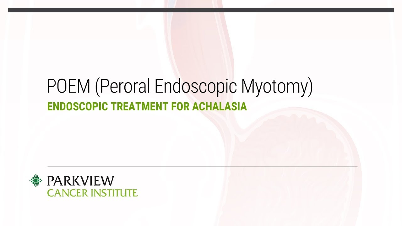 POEM (Peroral Endoscopic Myotomy): Endoscopic Treatment for Achalasia ...