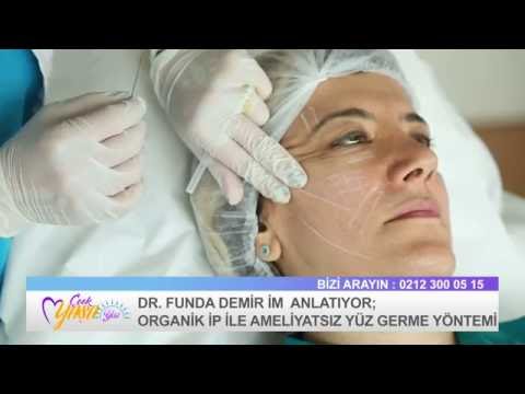DR FUNDA DEMİR İM  ORGANİK İP İLE AMELİYATSIZ YÜZ GERME YÖNTEMİ