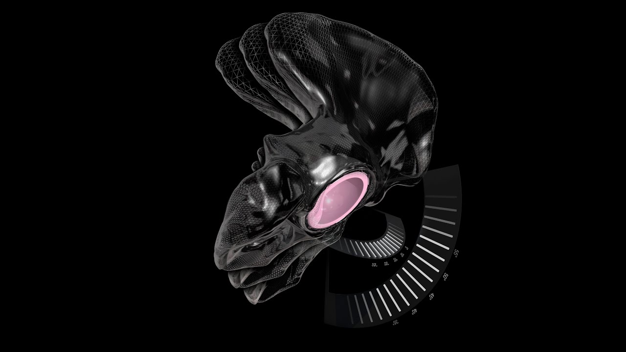 OPS Optimized Total Hip Replacements - YouTube