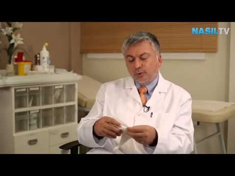 Göbek fıtığı ameliyatı nasıl yapılır  videolu anlatım   NASIL TV