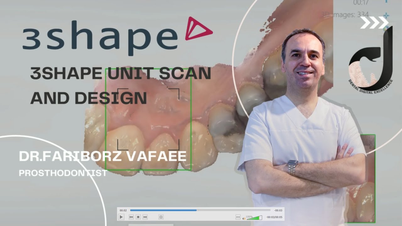 3shape unit scan and design tutorial (part1) - YouTube