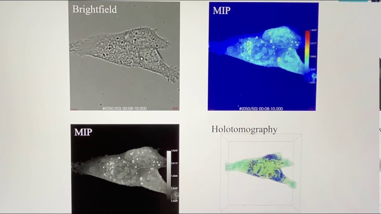 Tomocube 3D Imaging Holotomography with brightfield - YouTube
