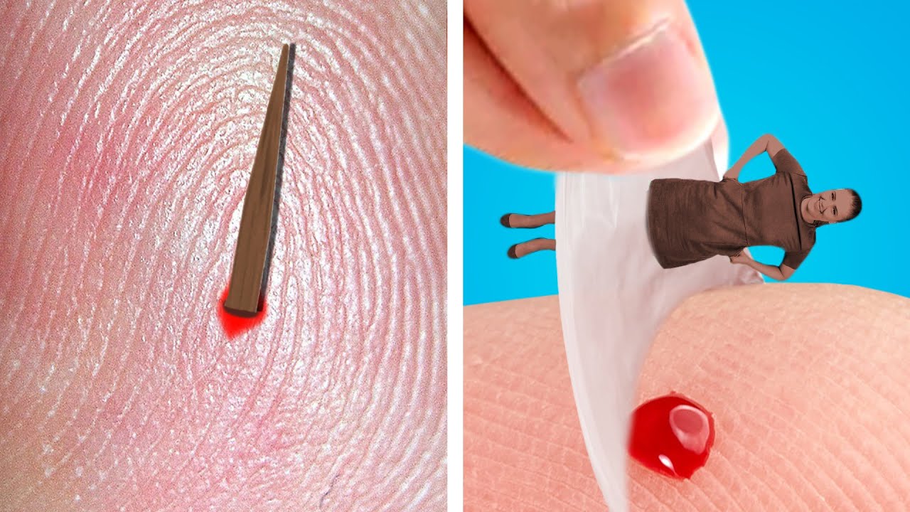 IF A SPLINTER WAS A PERSON! DIY Life Hacks & Funny Situations By Crafty ...