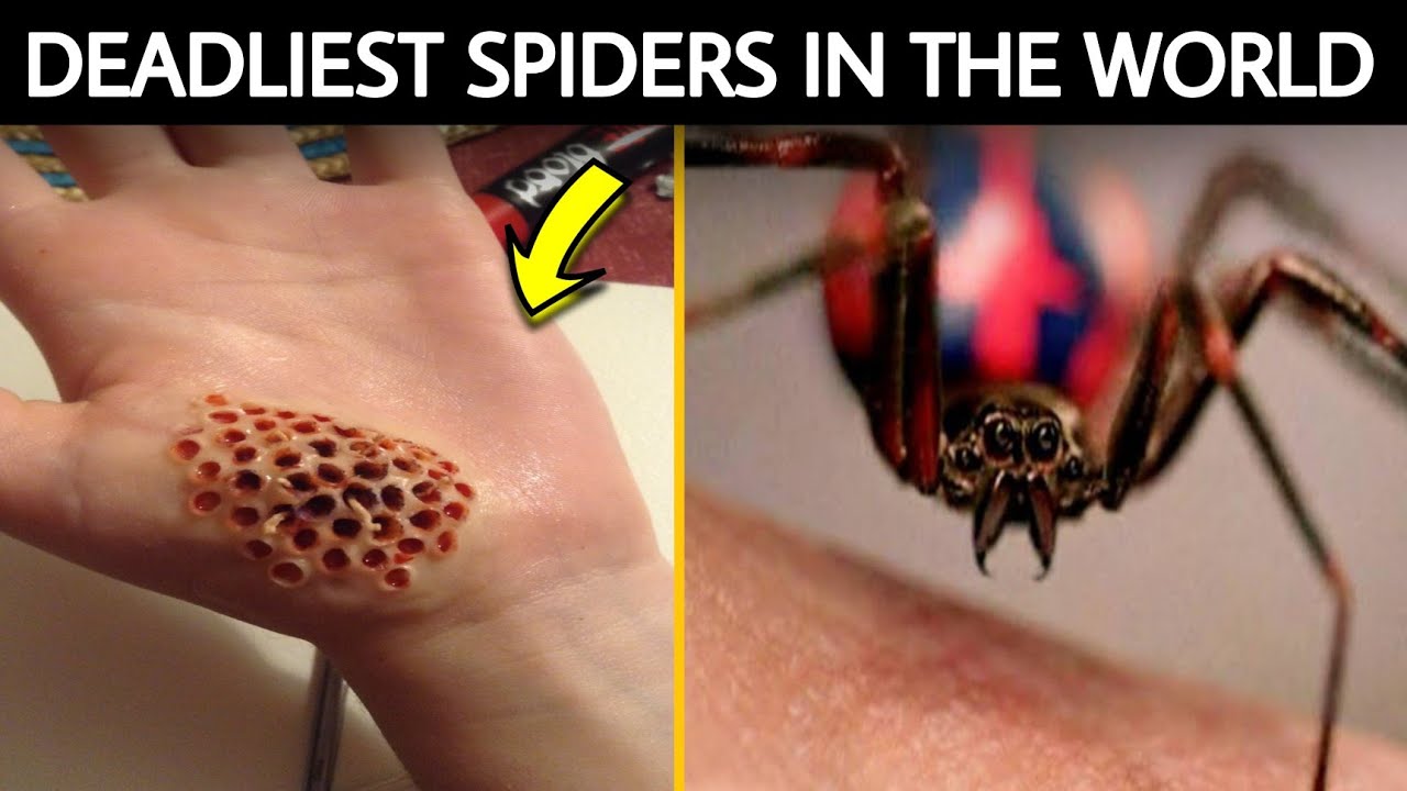Most Deadliest Spiders In The World | Brown Recluse Spider Bites ...