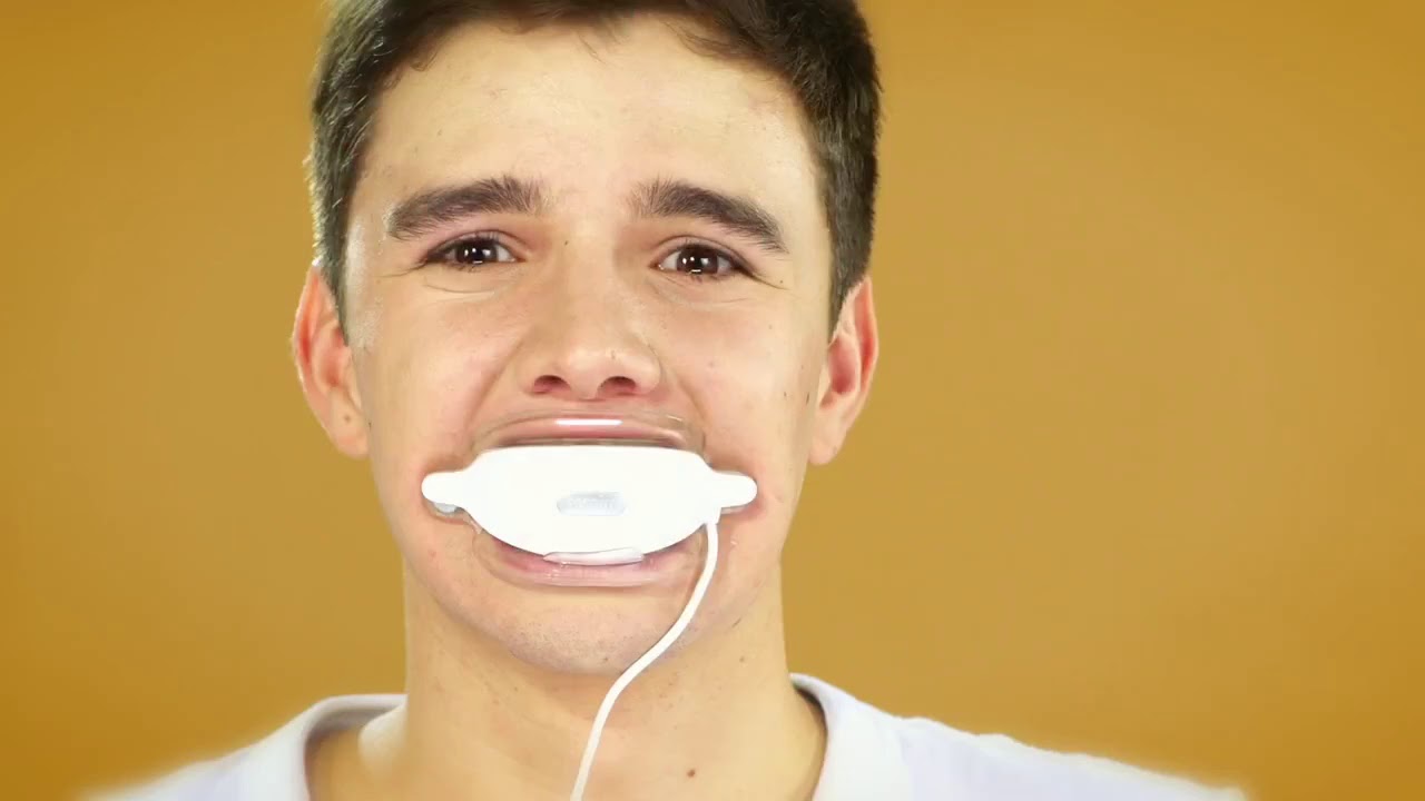 Gemini Teeth Whitening Home - YouTube