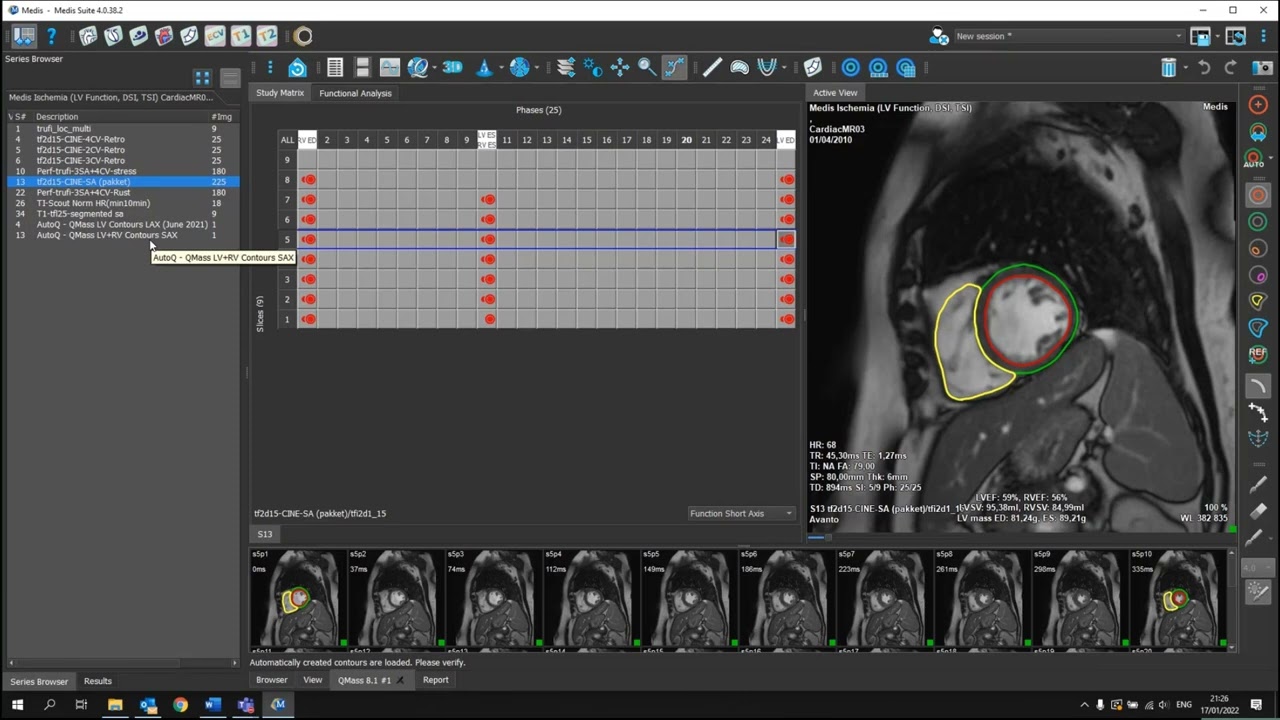 MR explained: Function Analysis - YouTube