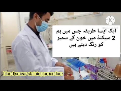 Staining of blood smear with field stain A & B practical lab (Dr.Haroon ...