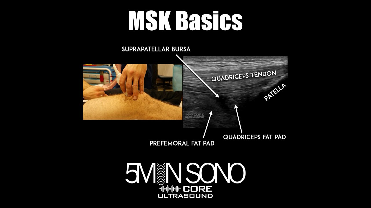 5 Minute Sono - MSK Basics - YouTube