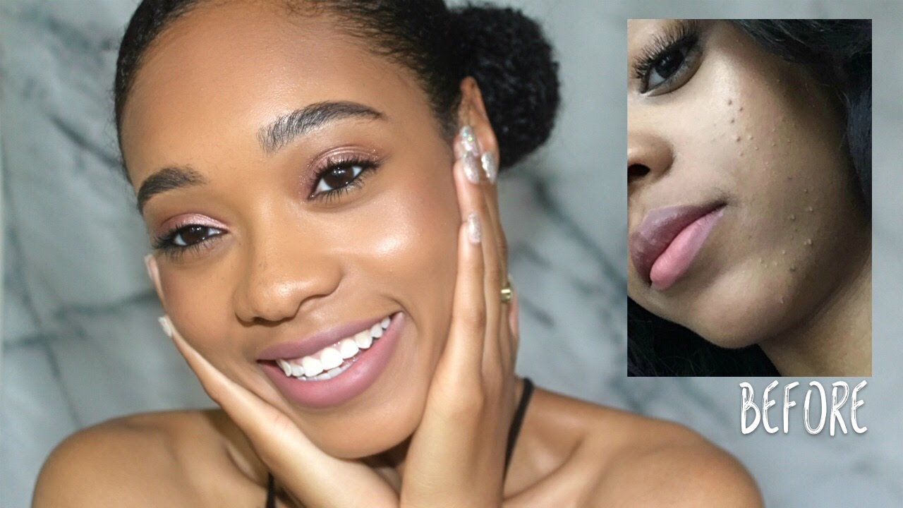 Skin Care Transformation / Healthy Skin Journey - YouTube