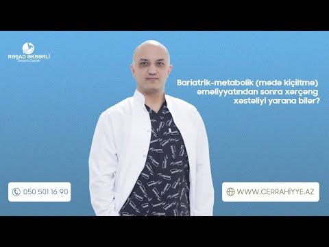 Bariatrik-metabolik (mədə kiçiltmə) əməliyyatından sonra xərçəng xəstəliyi yarana bilər?`