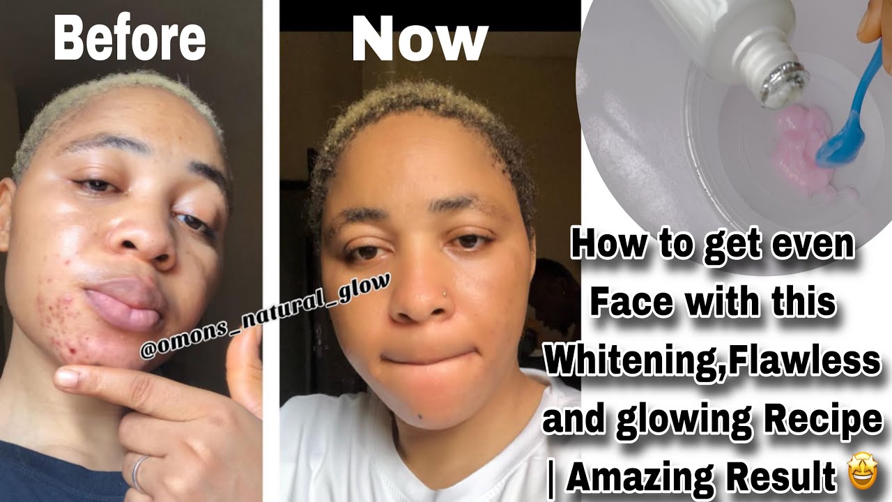 How to get even Face with this Whitening,Flawless and glowing Recipe ...