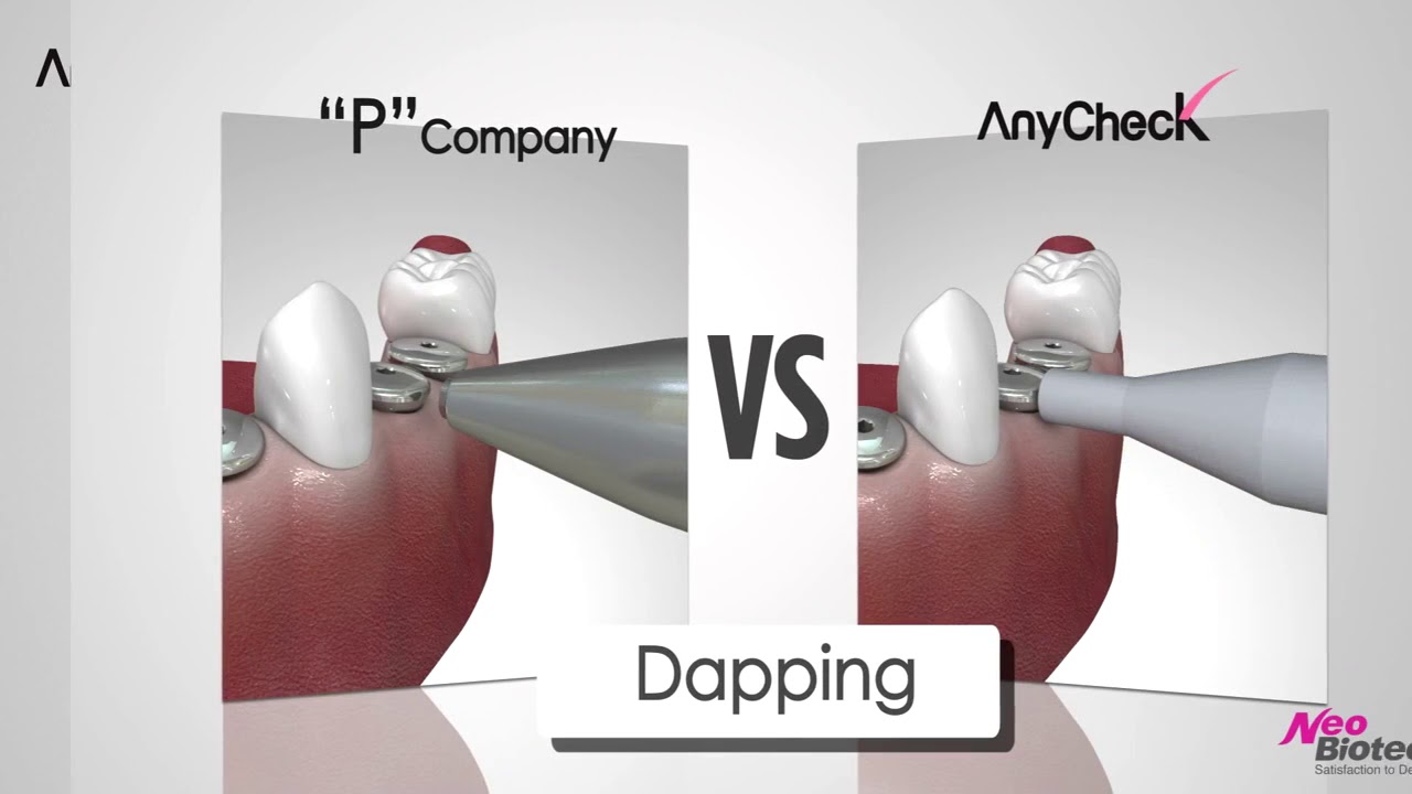 AnyCheck Animation - YouTube