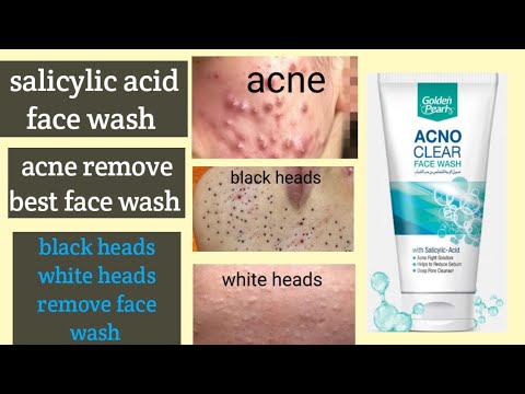 Golden pearl acno clear face wash review. best salicylic acid face wash ...