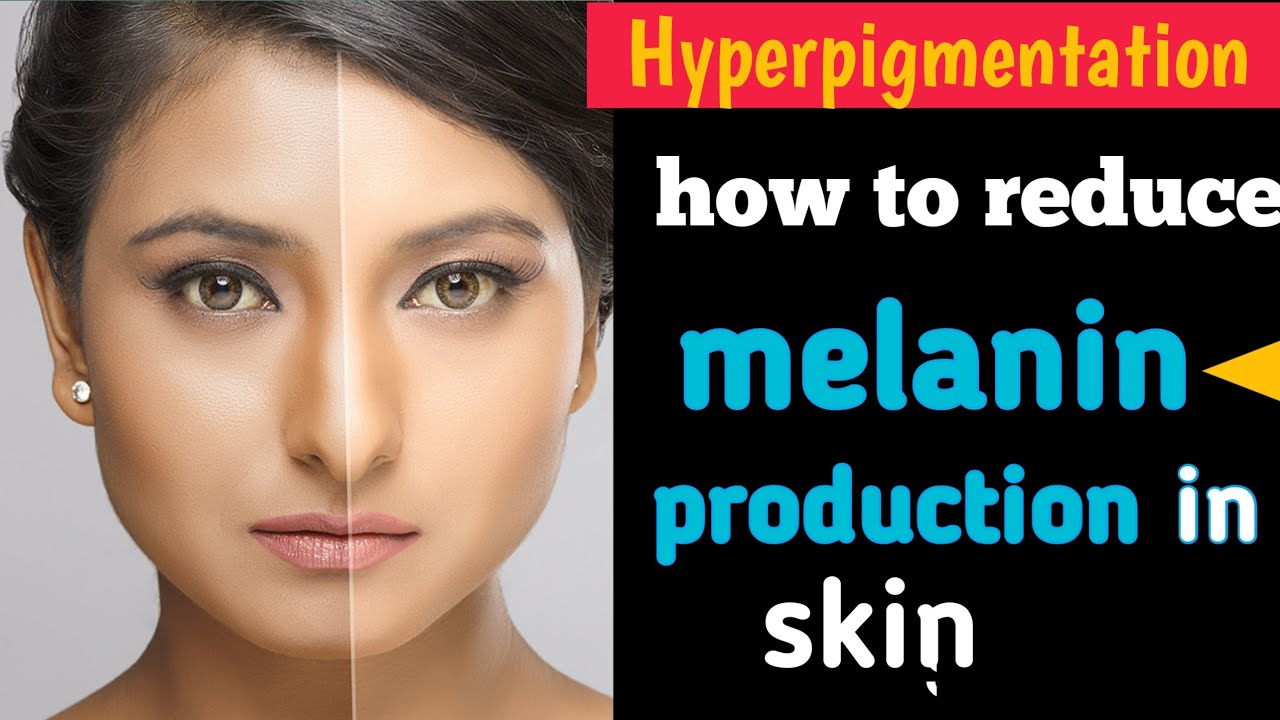 त्वचा में मेलेनिन उत्पादन को कैसे कम करें||How to reduce melanin ...