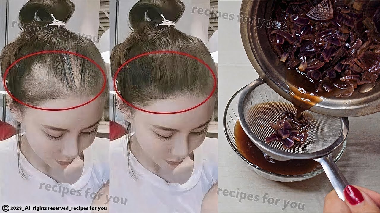 I tried this and my hair growth got doubled in 1 month-Increase Hair ...