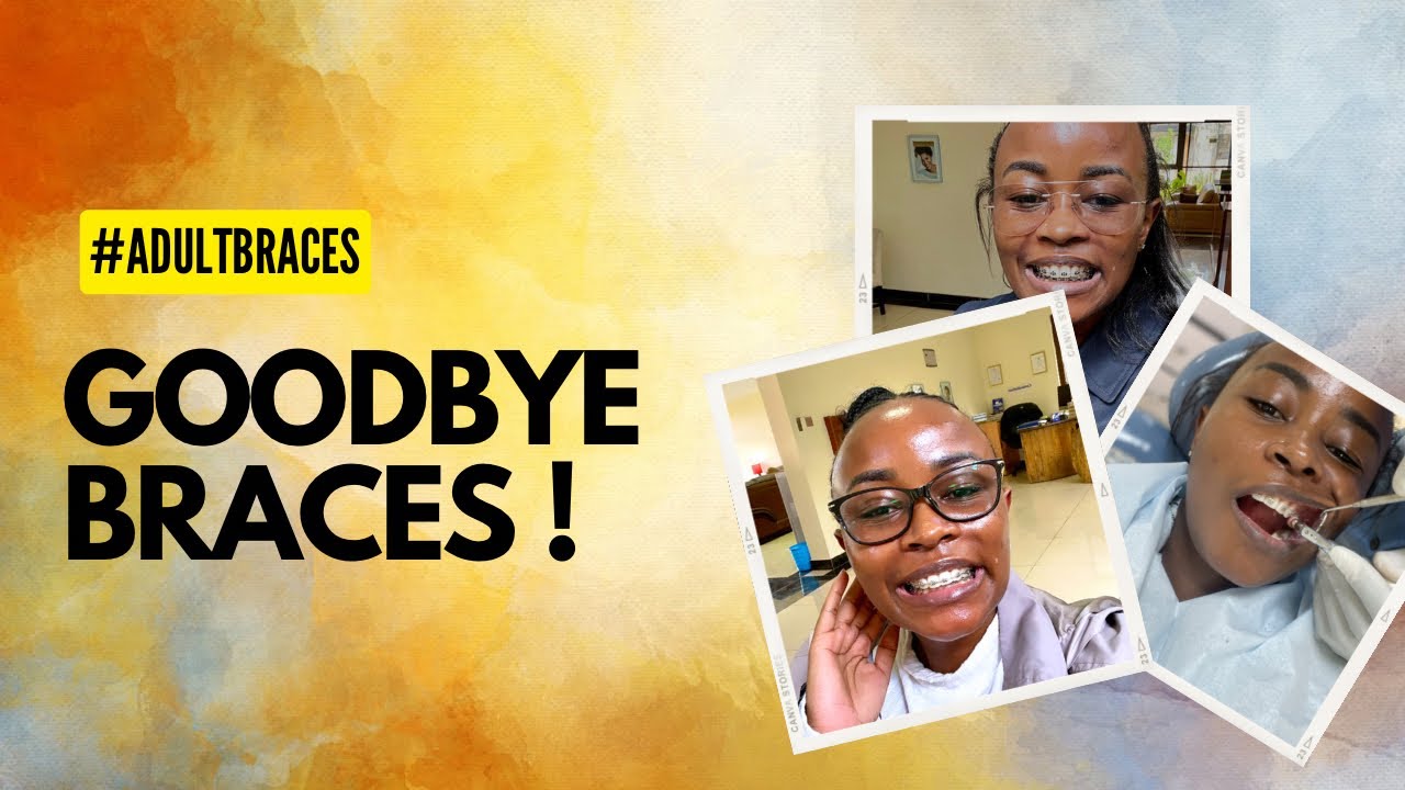 Goodbye To The Braces! | Part 1 - YouTube