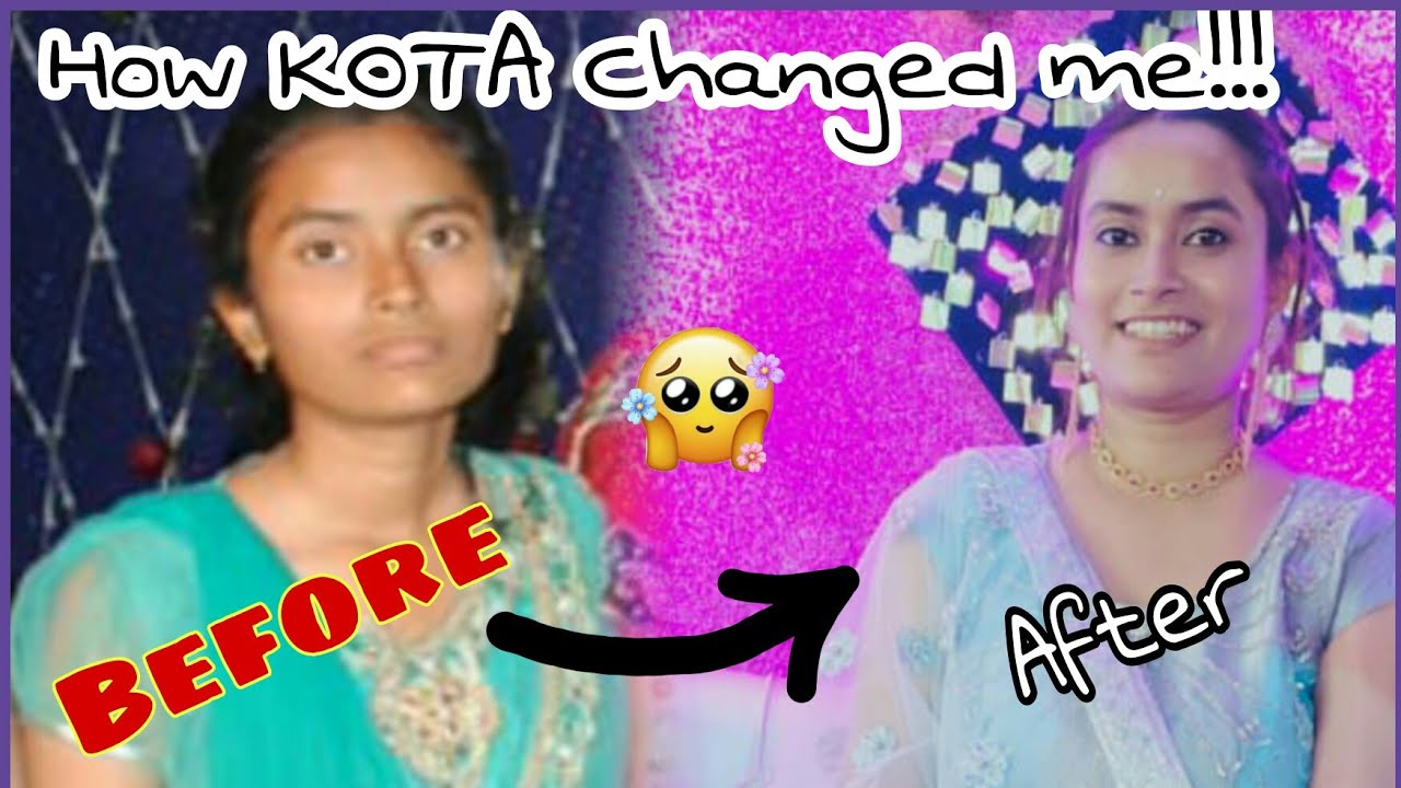 My Real Kota Journey Experience||KOTA Ka Asli Sach||Dreamyapa girl|part ...