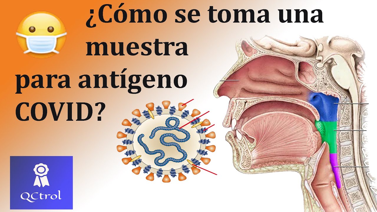 Como se toma la muestra de antígeno COVID? Exudado nasofaríngeo - YouTube