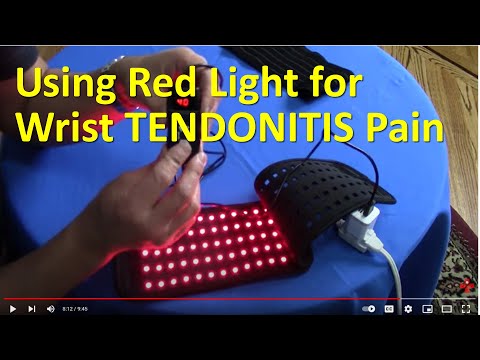 Does Red Light Therapy Help Carpal Tunnel Syndrome