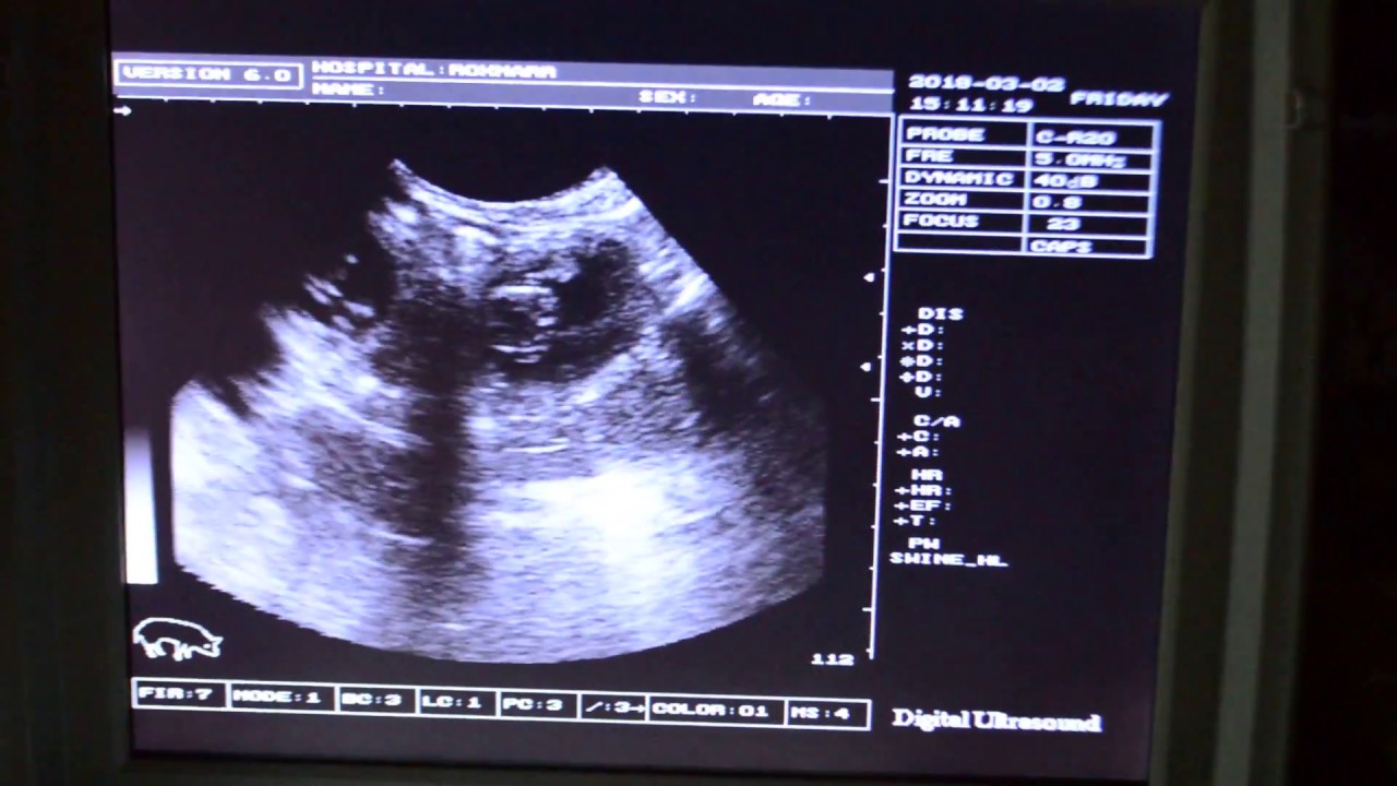 Babies at 5 weeks - YouTube