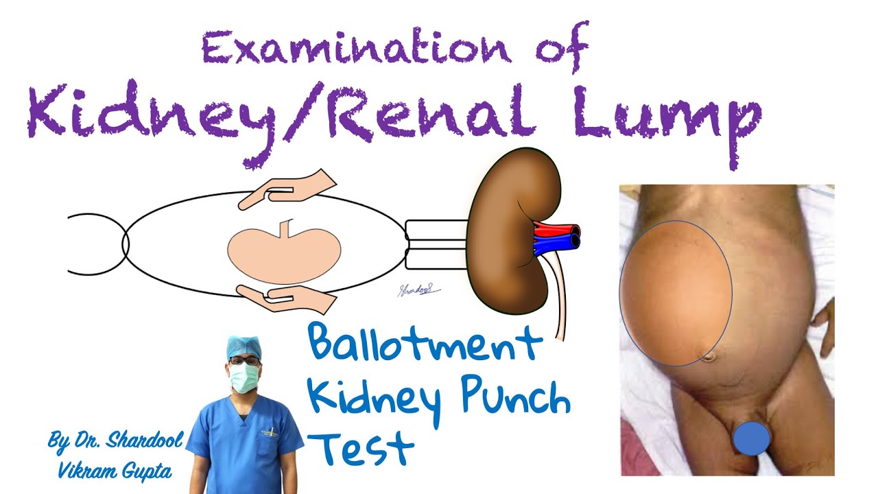 Examination of Kidney/ Renal Lump for MBBS, MS Surgery medical students - YouTube