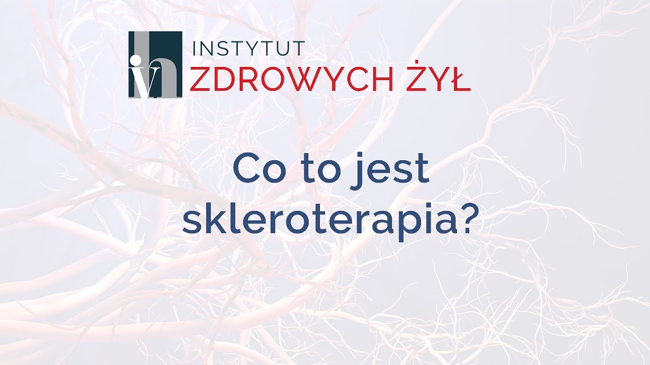 Co to jest skleroterapia? - YouTube
