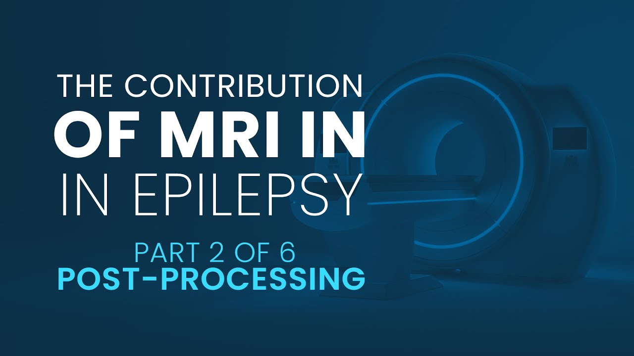 The contribution of MRI in Epilepsy | Part 2 Post-Processing - YouTube