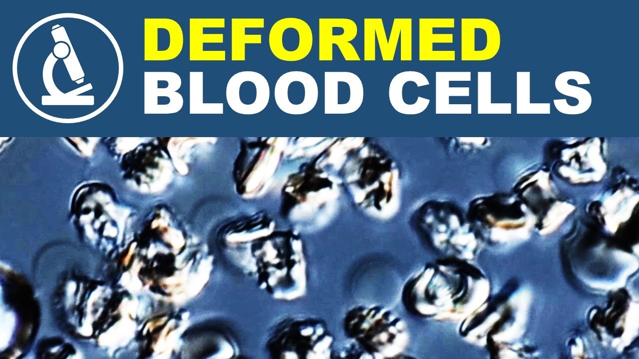 Why SALT causes cells to shrink | Blood under the microscope - YouTube