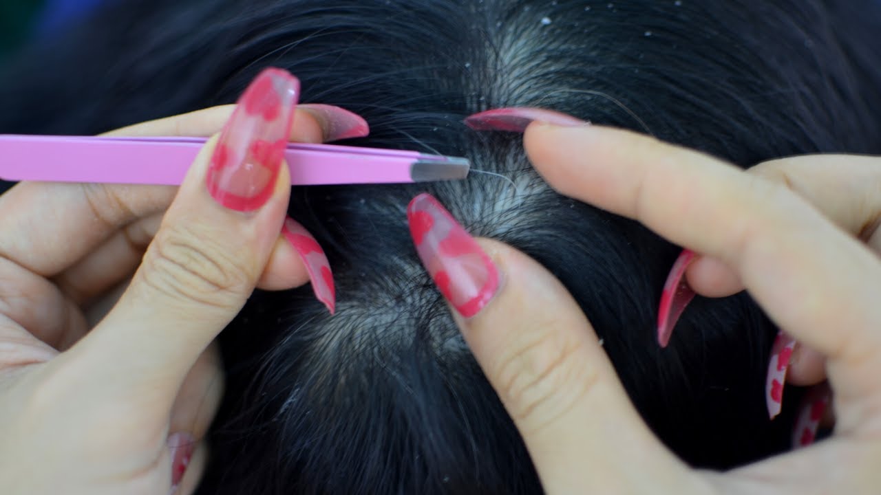 ASMR Scalp Check, Scalp Nitpicking ( Plucking White Hair & Hair Care ...