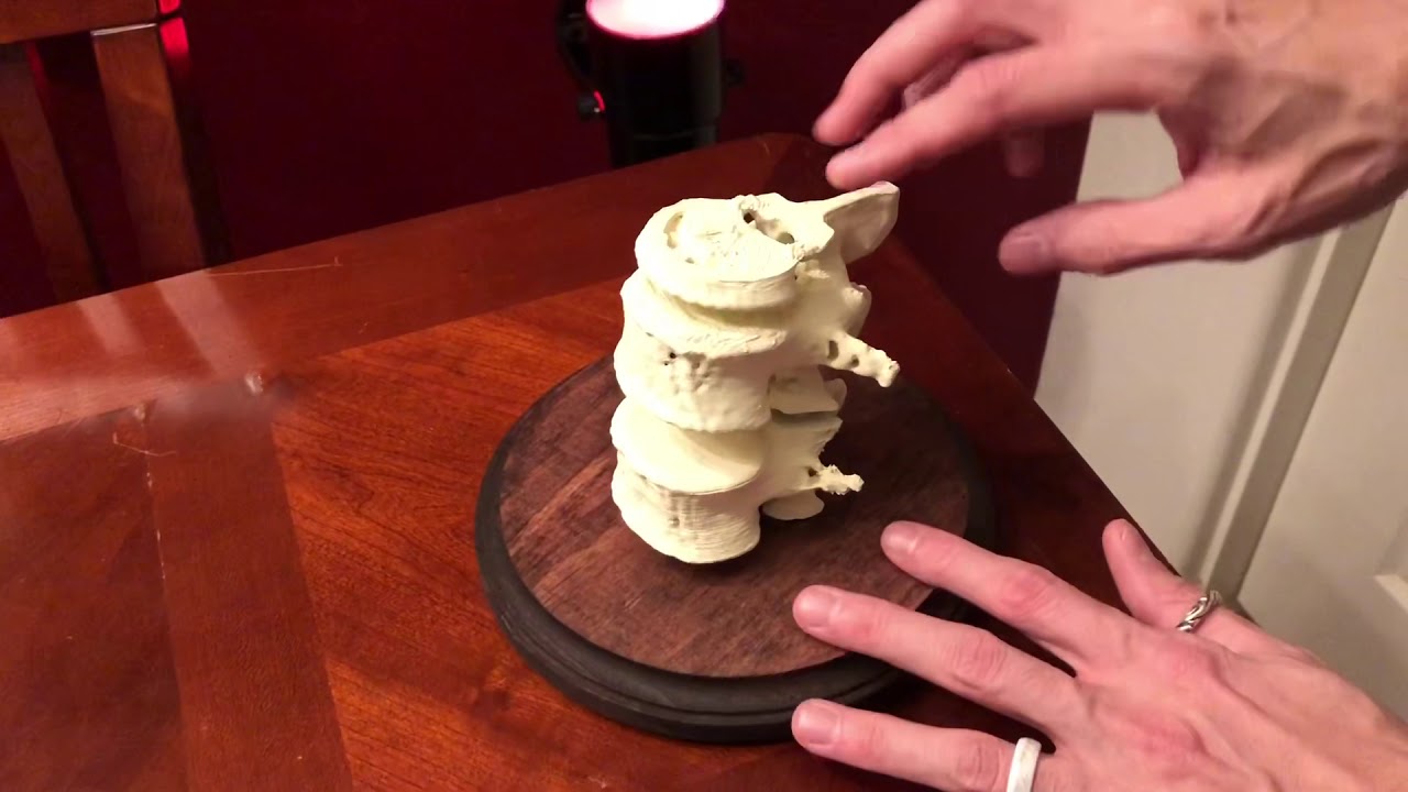 3D Printed MRI Scan - YouTube