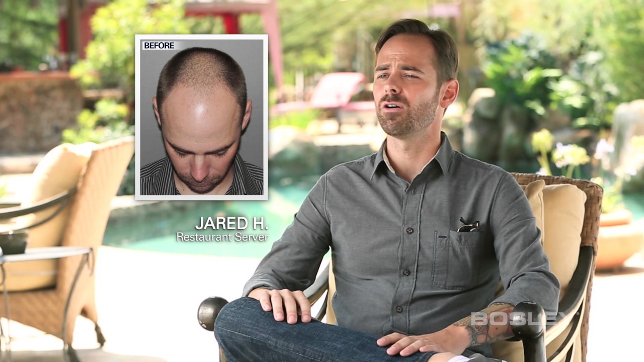 Bosley Hair Transplant Patient Review - Jared H. - YouTube