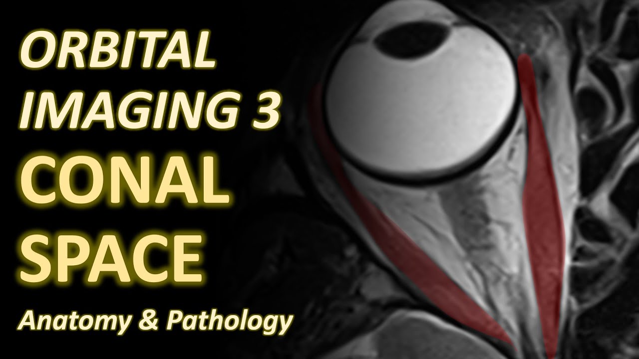 Imaging of the eye, orbits and visual tracts (part 3): the conal space ...