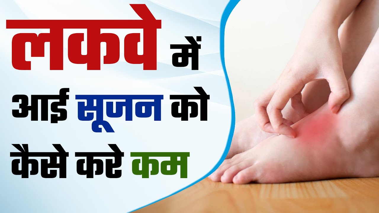 लकवे में आई शरीर की सूजन को कैसे कम करें? | Paralyzed patient treatment ...