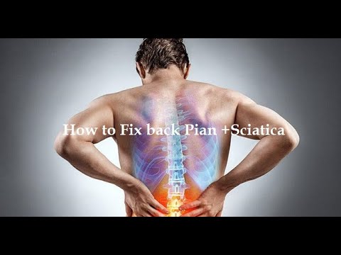 How to fix your back pain + Sciatica - YouTube